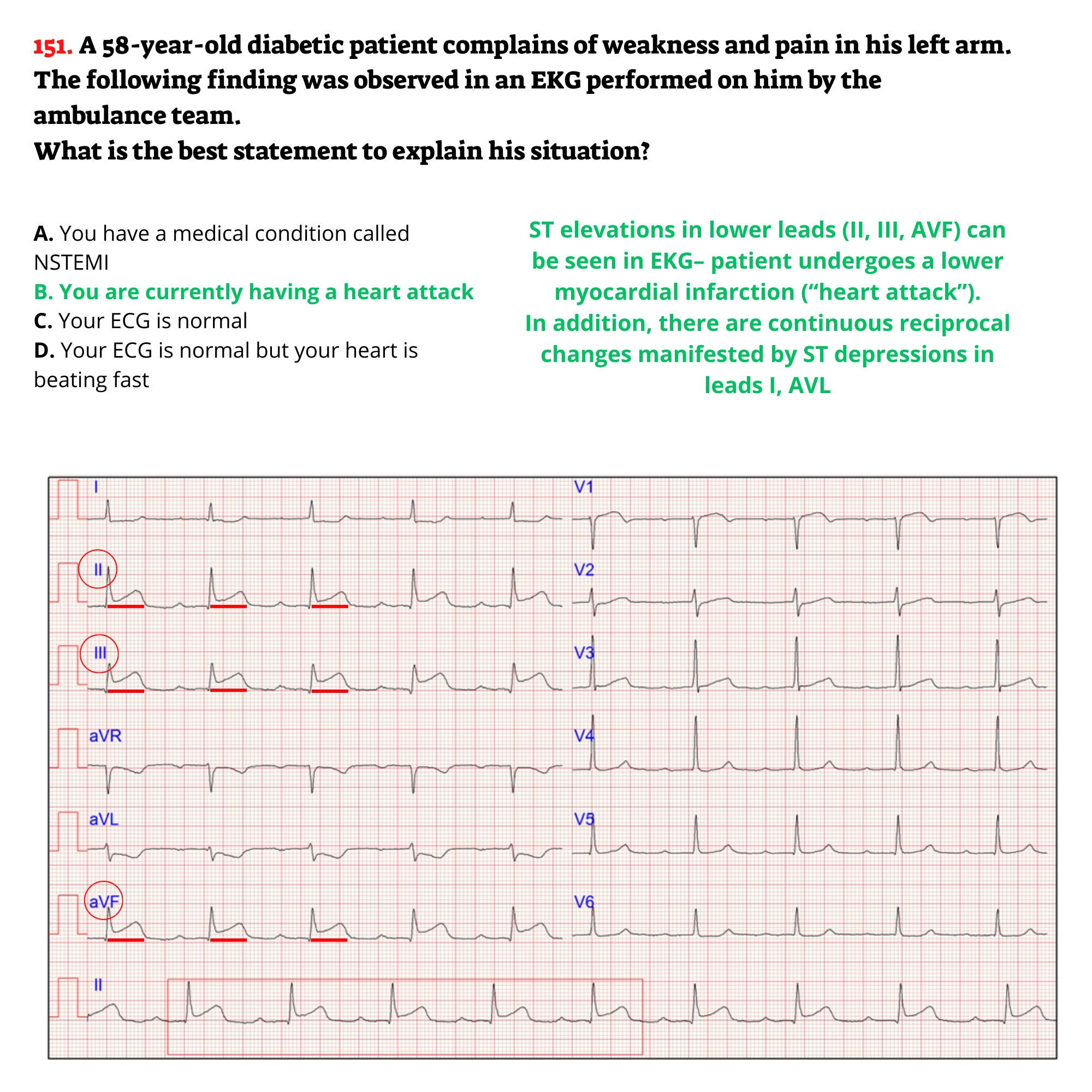EKG Practice Test With Answers, EKG Practice Quiz, Quiz for Nursing ...