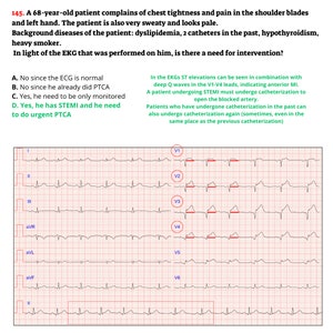EKG Practice Test With Answers, EKG Practice Quiz, Quiz for Nursing ...
