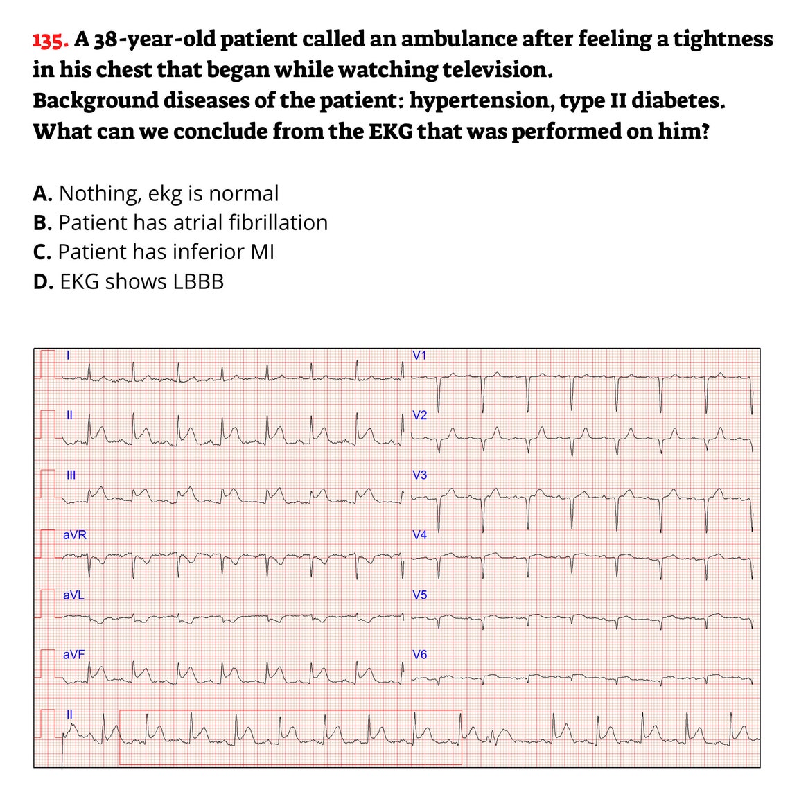 EKG Practice Test With Answers, EKG Practice Quiz, Quiz for Nursing ...