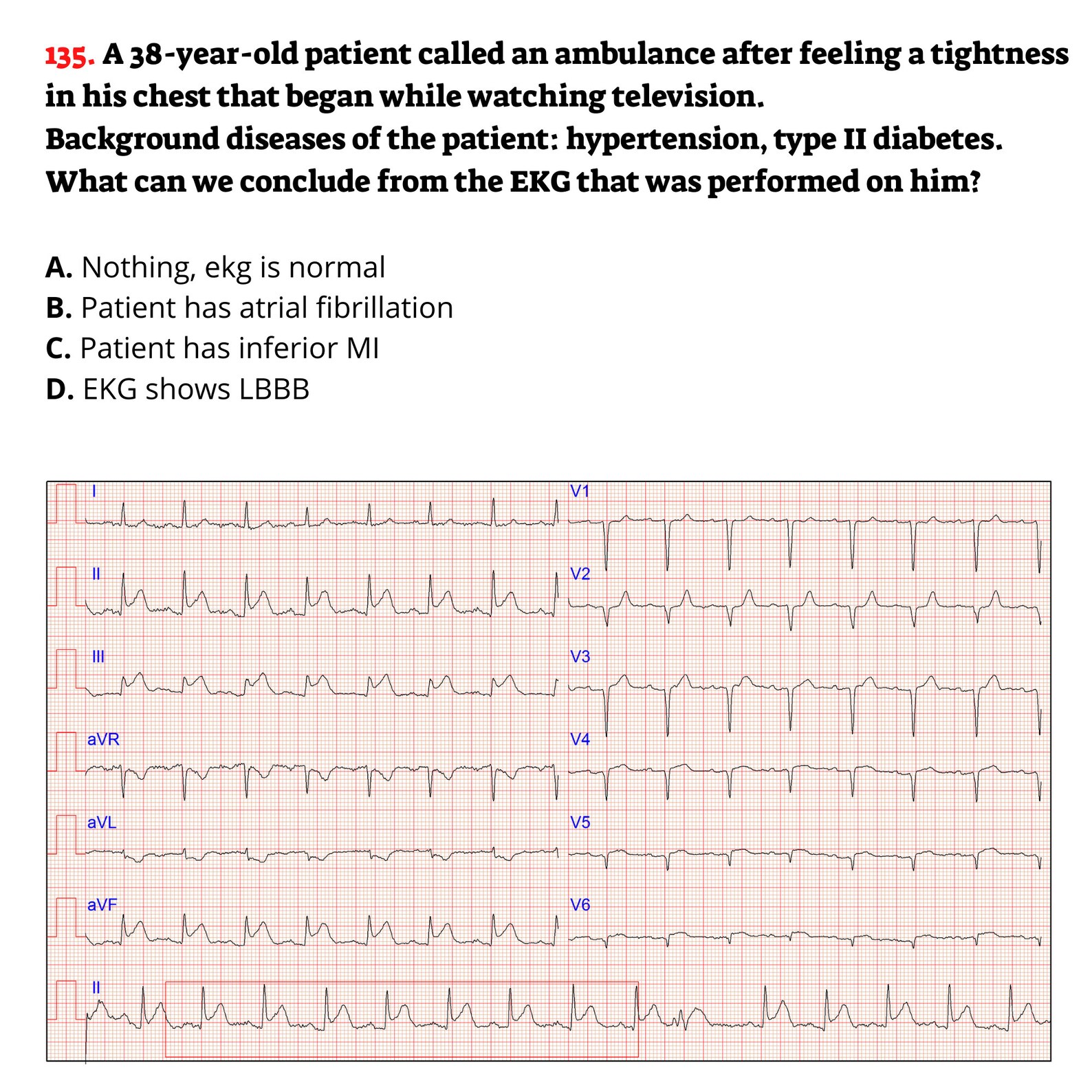 EKG Practice Test With Answers, EKG Practice Quiz, Quiz for Nursing ...