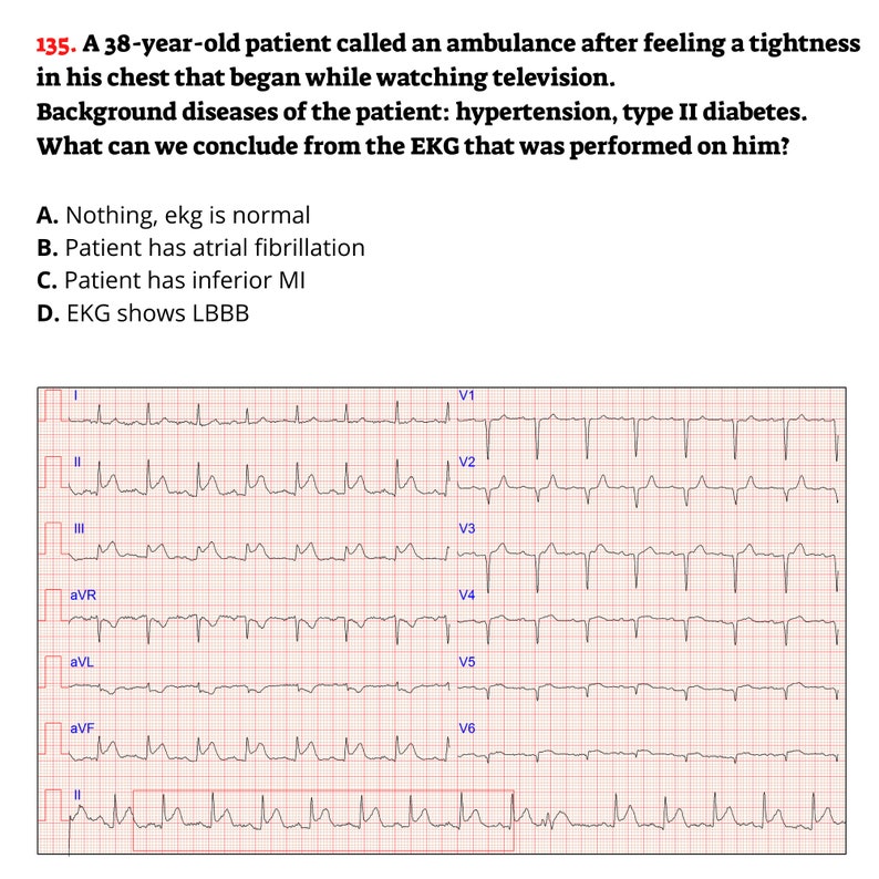 EKG Practice Test With Answers, EKG Practice Quiz, Quiz for Nursing ...