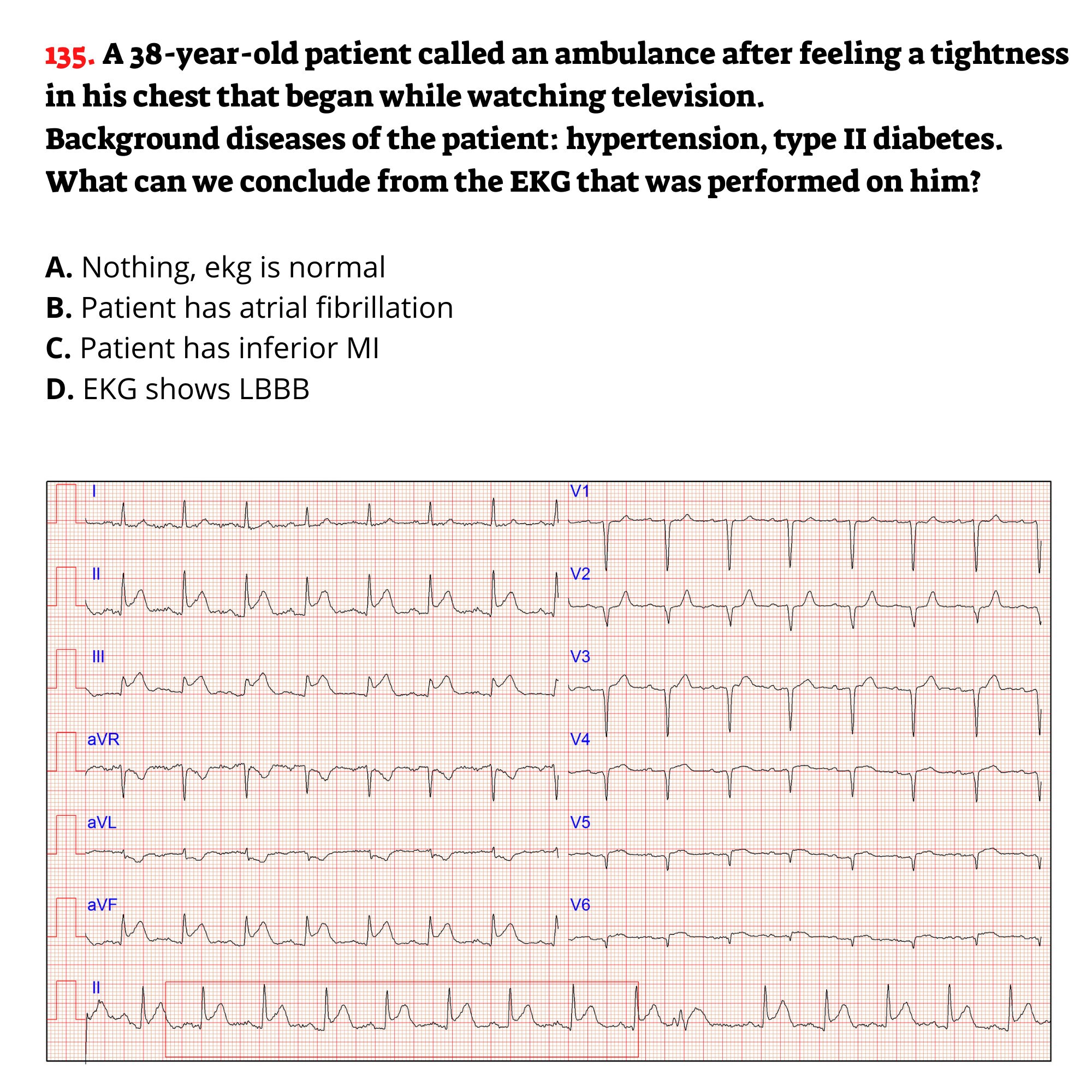 EKG Practice Test With Answers, EKG Practice Quiz, Quiz for Nursing ...