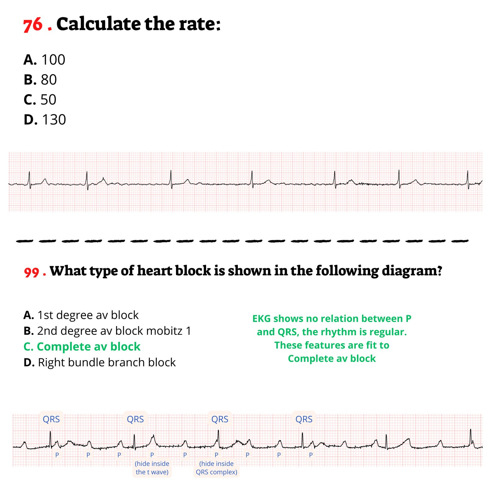 EKG Practice Test With Answers, EKG Practice Quiz, Quiz for Nursing ...