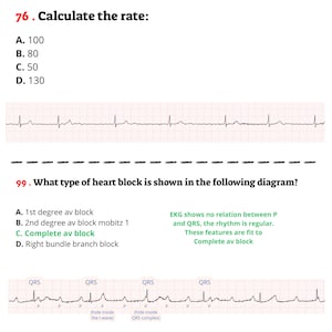 EKG Practice Test With Answers, EKG Practice Quiz, Quiz for Nursing ...