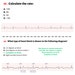EKG Practice Test With Answers, EKG Practice Quiz, Quiz for Nursing ...