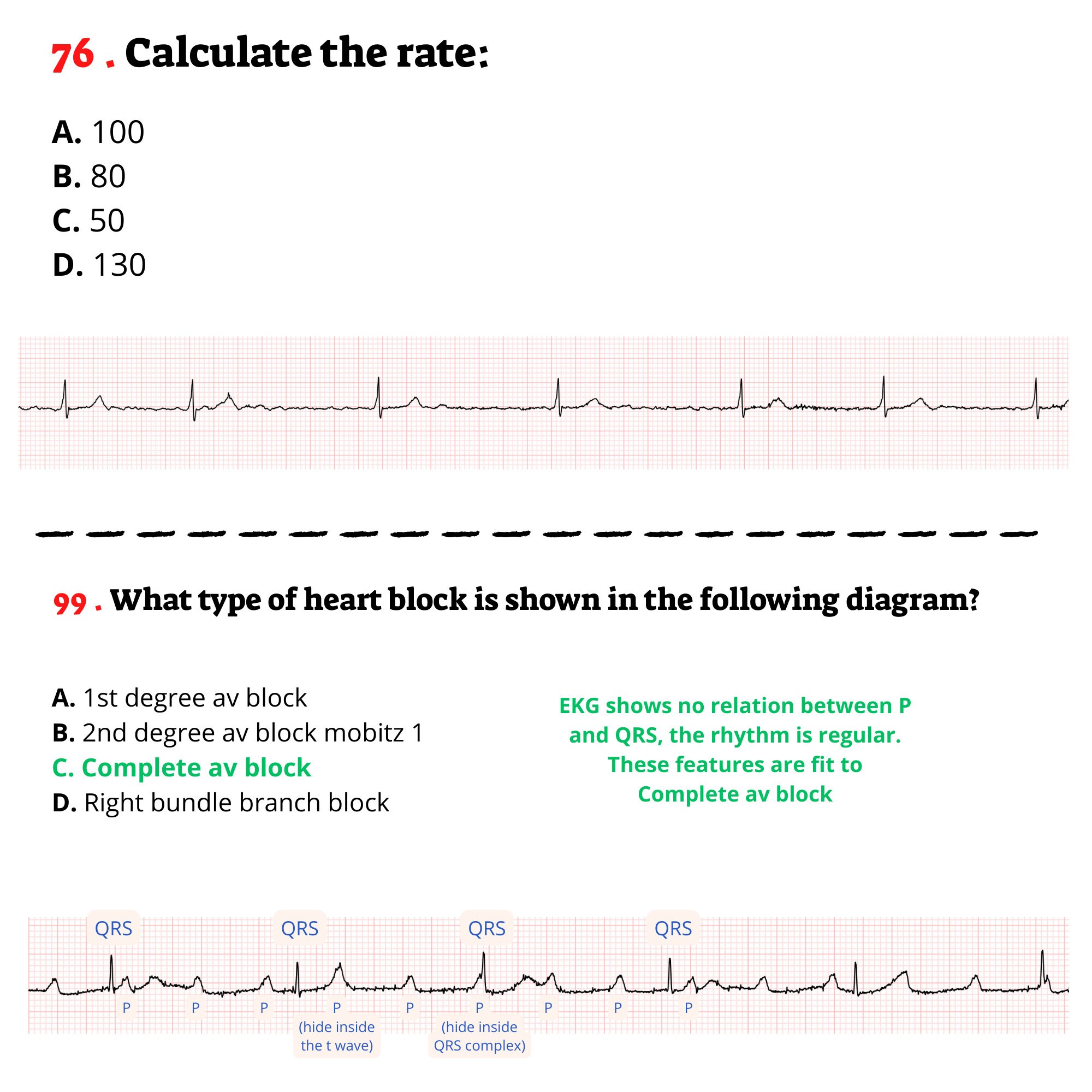 EKG Practice Test With Answers, EKG Practice Quiz, Quiz for Nursing ...