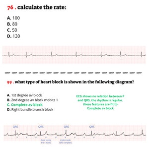 EKG Practice Test With Answers, EKG Practice Quiz, Quiz for Nursing ...
