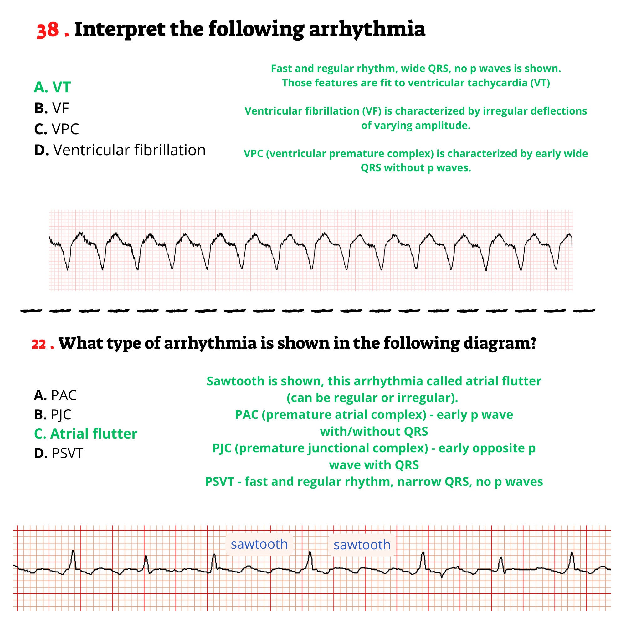EKG Practice Test With Answers, EKG Practice Quiz, Quiz for Nursing ...