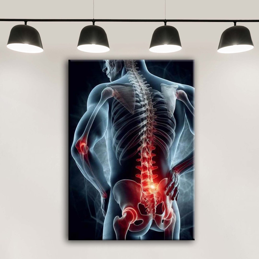 Physiotherapy Doctor and Physiotherapy Hospital Decor Canvas Wall Art ...