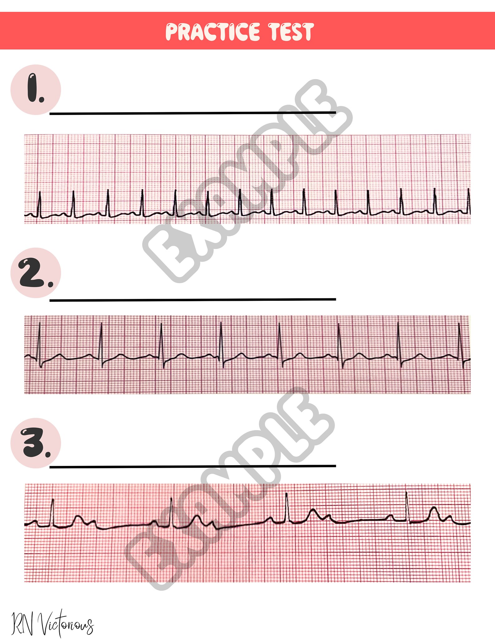 EKG Cheat Sheet: Rhythm Study Guide & Practice (PDF Download) - Etsy