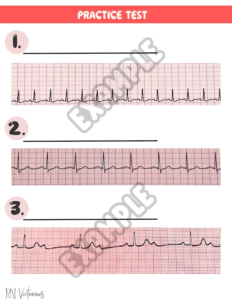 EKG Cheat Sheet: Rhythm Interpretation & Dysrhythmias (digital Download ...