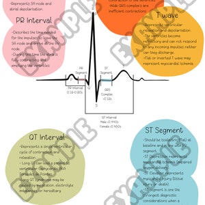 EKG Cheat Sheet: Rhythm Study Guide & Practice (PDF Download) - Etsy