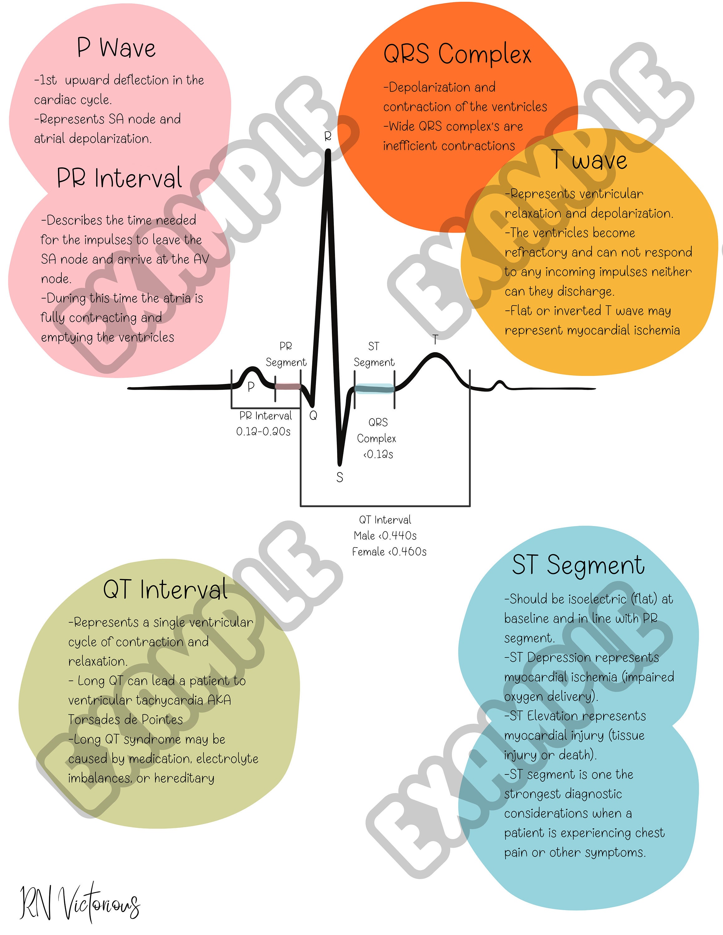 EKG Cheat Sheet: Rhythm Study Guide & Practice (PDF Download) - Etsy
