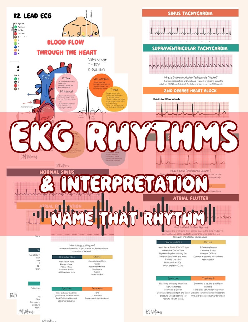 EKG Cheat Sheet: Rhythm Interpretation & Dysrhythmias (digital Download ...