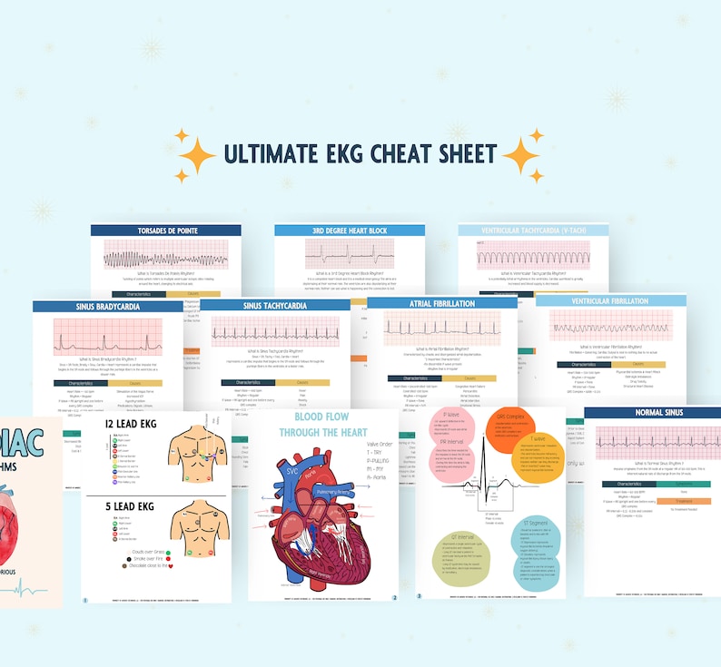 EKG Cheat Sheet EKG Study Guide EKG Practice - Etsy
