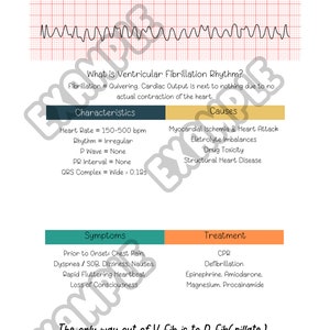 EKG Cheat Sheet: Rhythm Study Guide & Practice (PDF Download) - Etsy