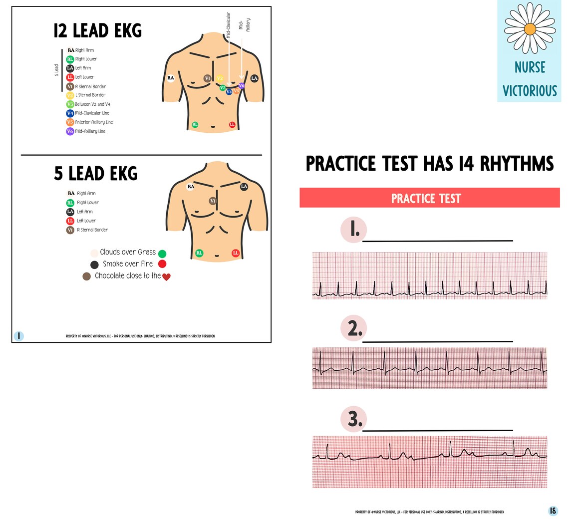 EKG Cheat Sheet: Cardiac Dysrhythmias Study Guide - Etsy