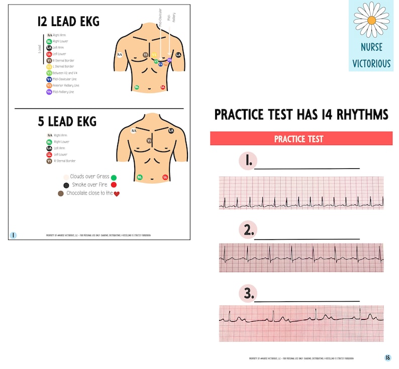 EKG Cheat Sheet: Cardiac Dysrhythmias Study Guide - Etsy
