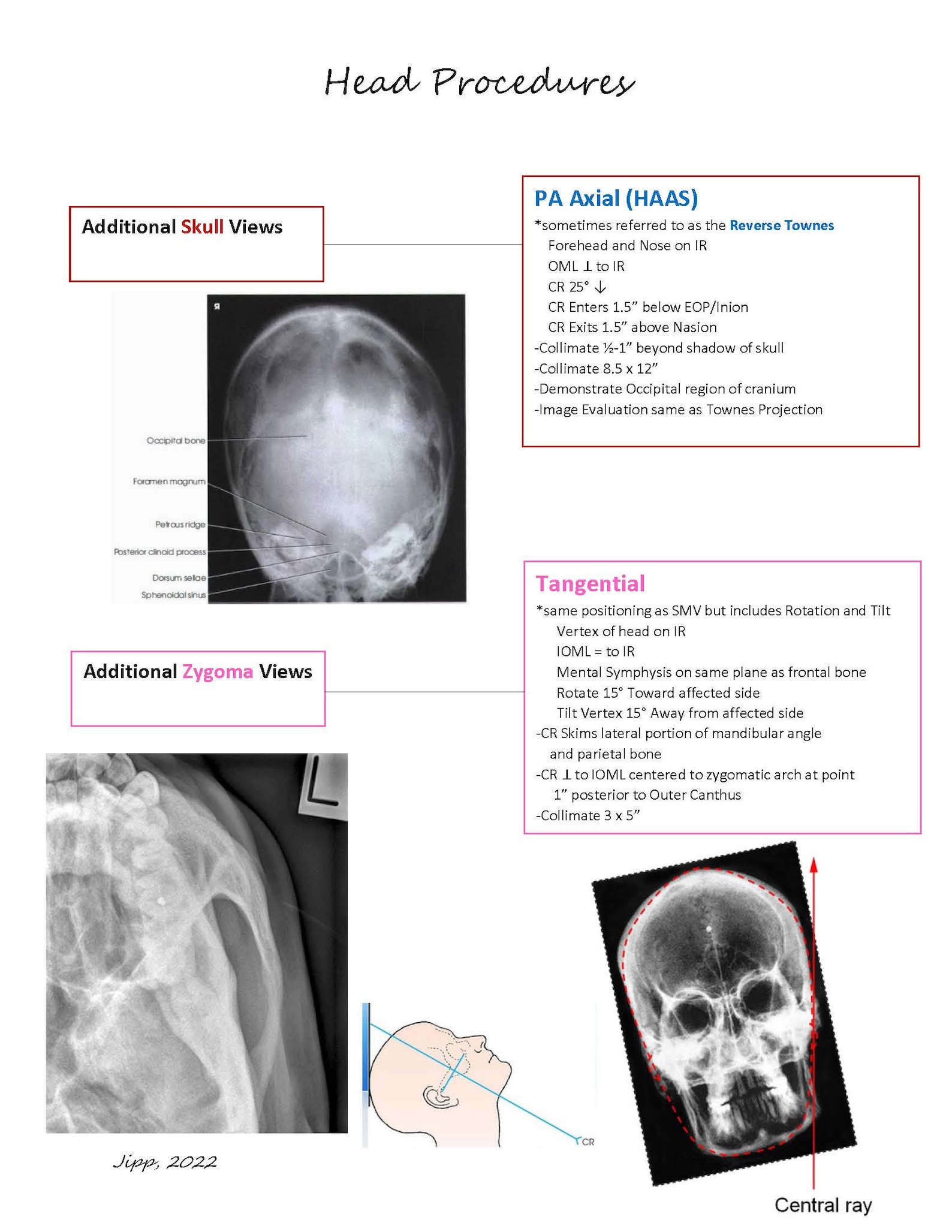 Skull Positioning and Procedures - Etsy