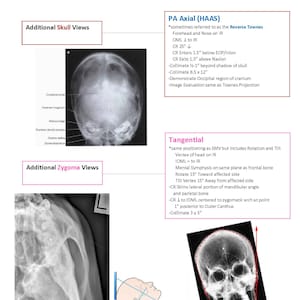 Skull Positioning and Procedures - Etsy