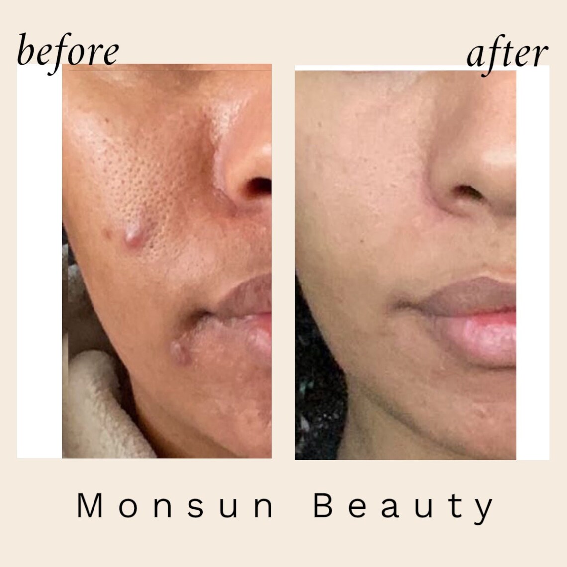 Qasil Organics Pure Qasil Mask Powder for Hair and Skin, Skincare ...