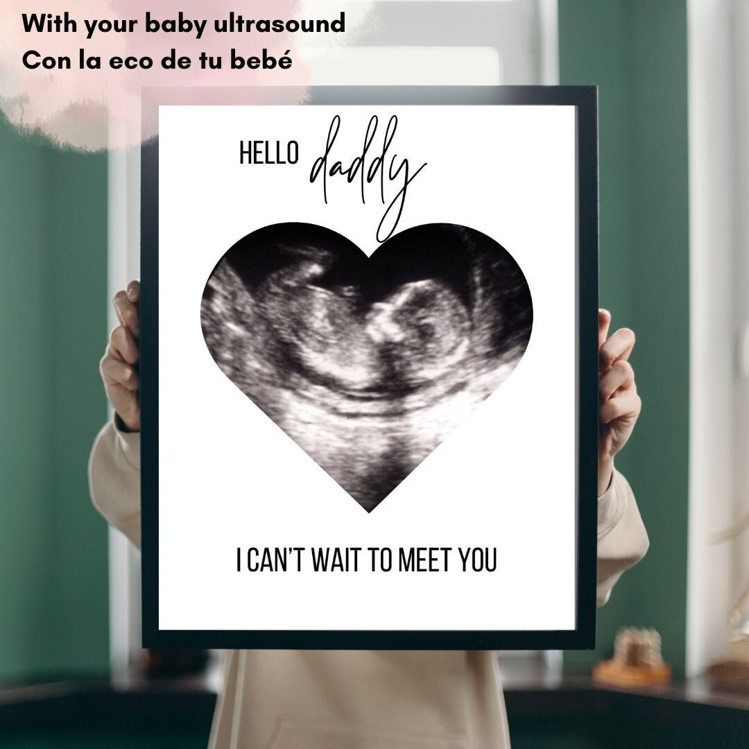 Baby Announcement, Ultrasound Poster for Dad, Gift for Baby Shower and ...