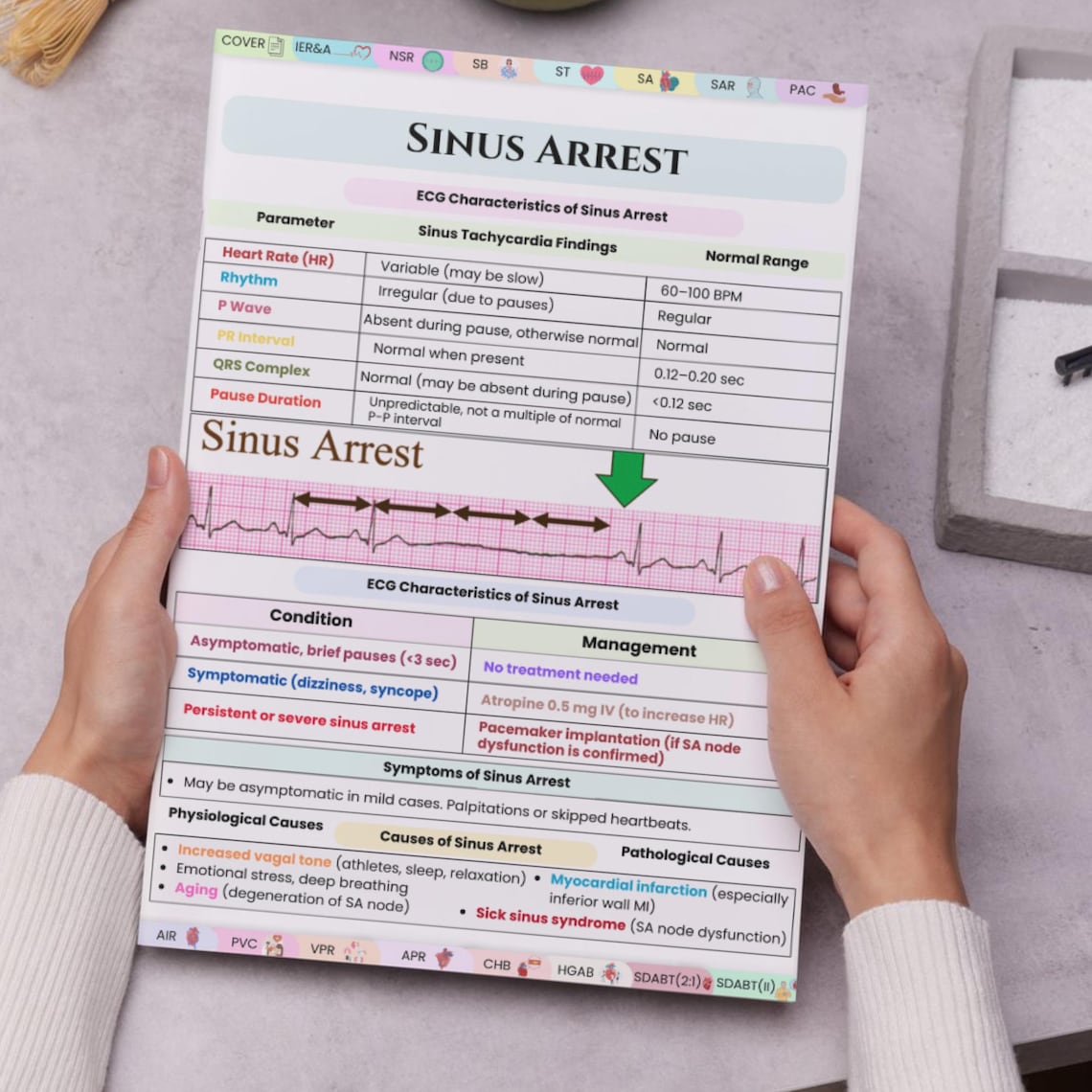 75+ ECG Rhythm & Arrhythmias Cheat Sheet, ECG Study Guide, Nursing ...