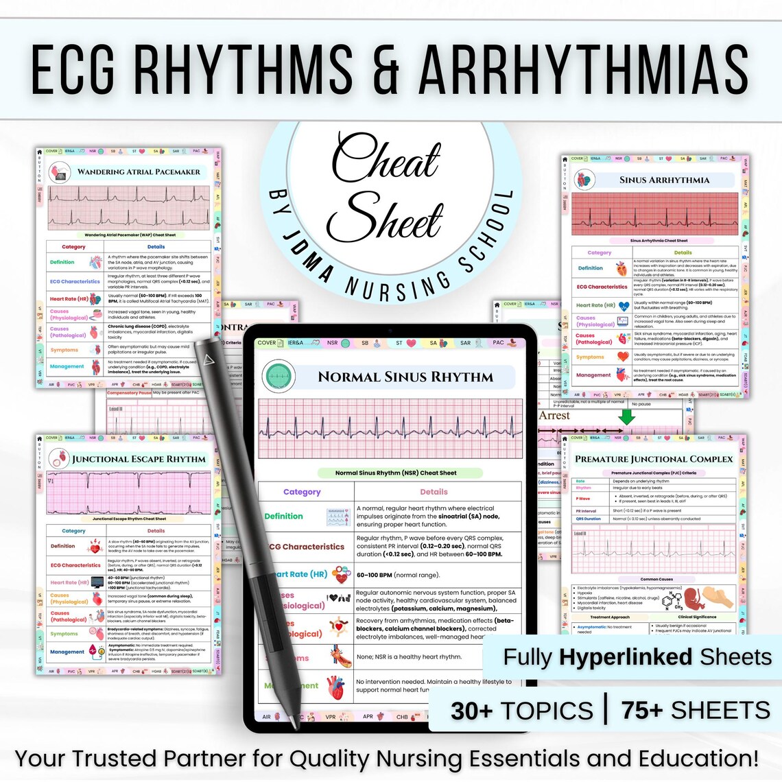 75+ ECG Rhythm & Arrhythmias Cheat Sheet, ECG Study Guide, Nursing ...