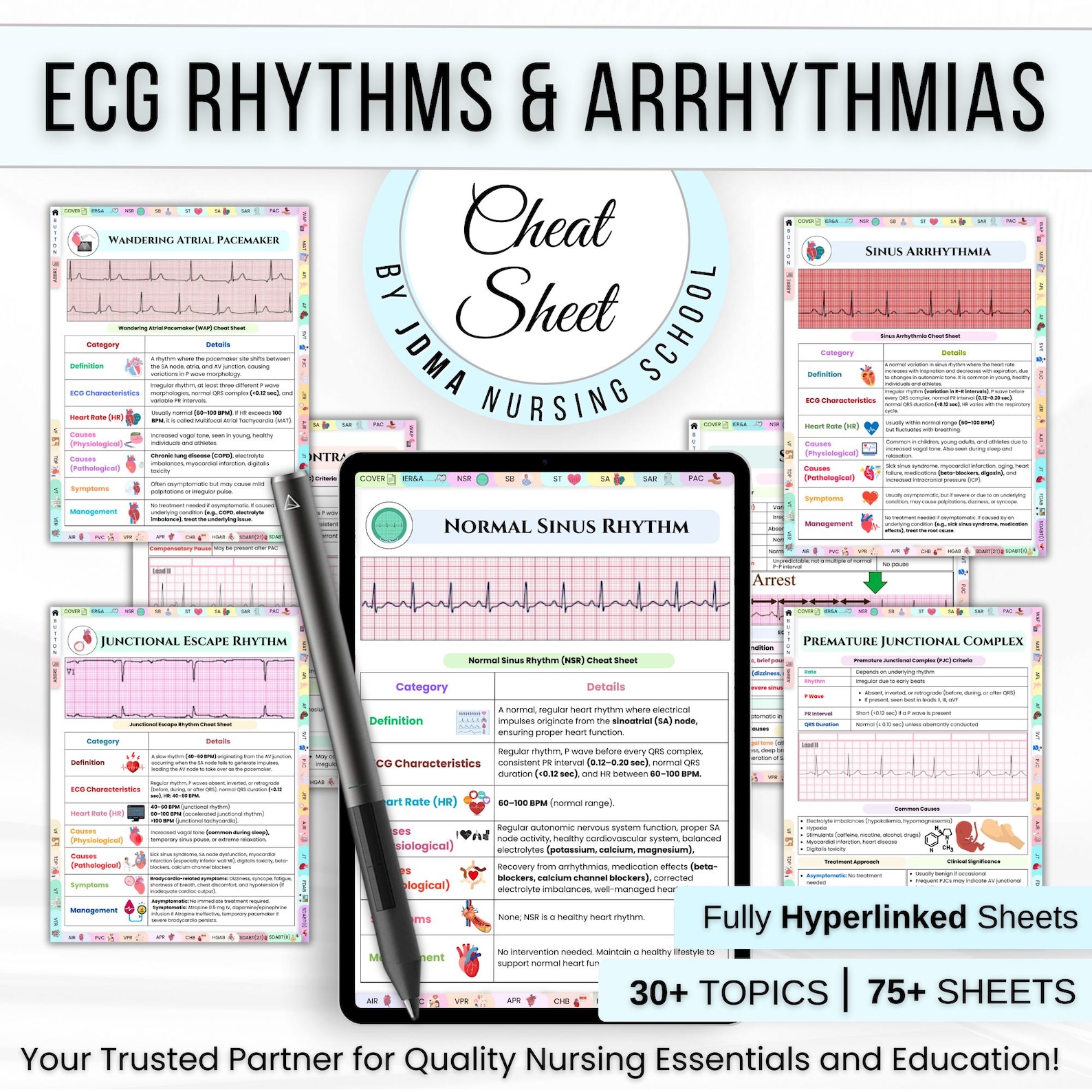 75+ ECG Rhythm & Arrhythmias Cheat Sheet, ECG Study Guide, Nursing ...