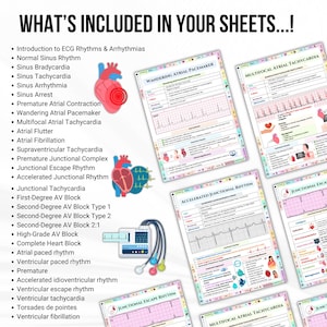 75+ ECG Rhythm & Arrhythmias Cheat Sheet, ECG Study Guide, Nursing ...