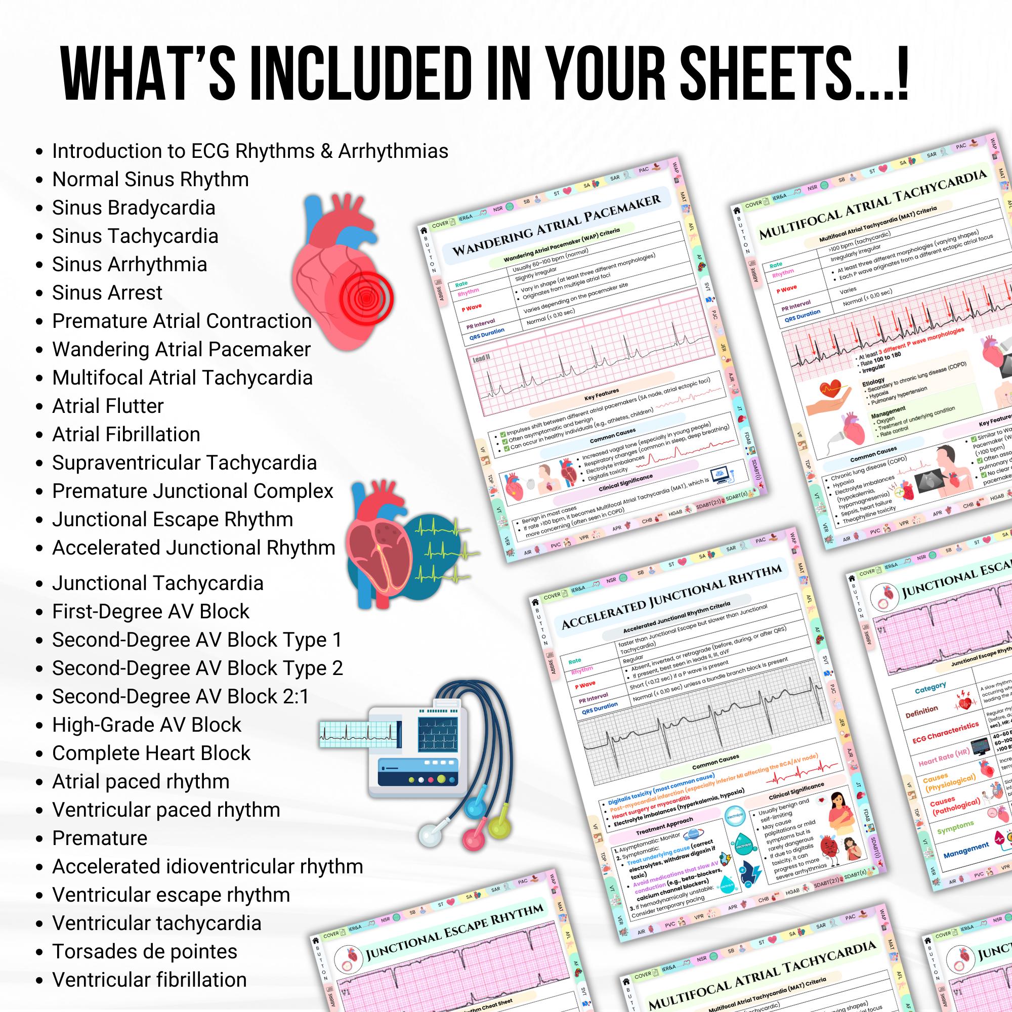 75+ ECG Rhythm & Arrhythmias Cheat Sheet, ECG Study Guide, Nursing ...
