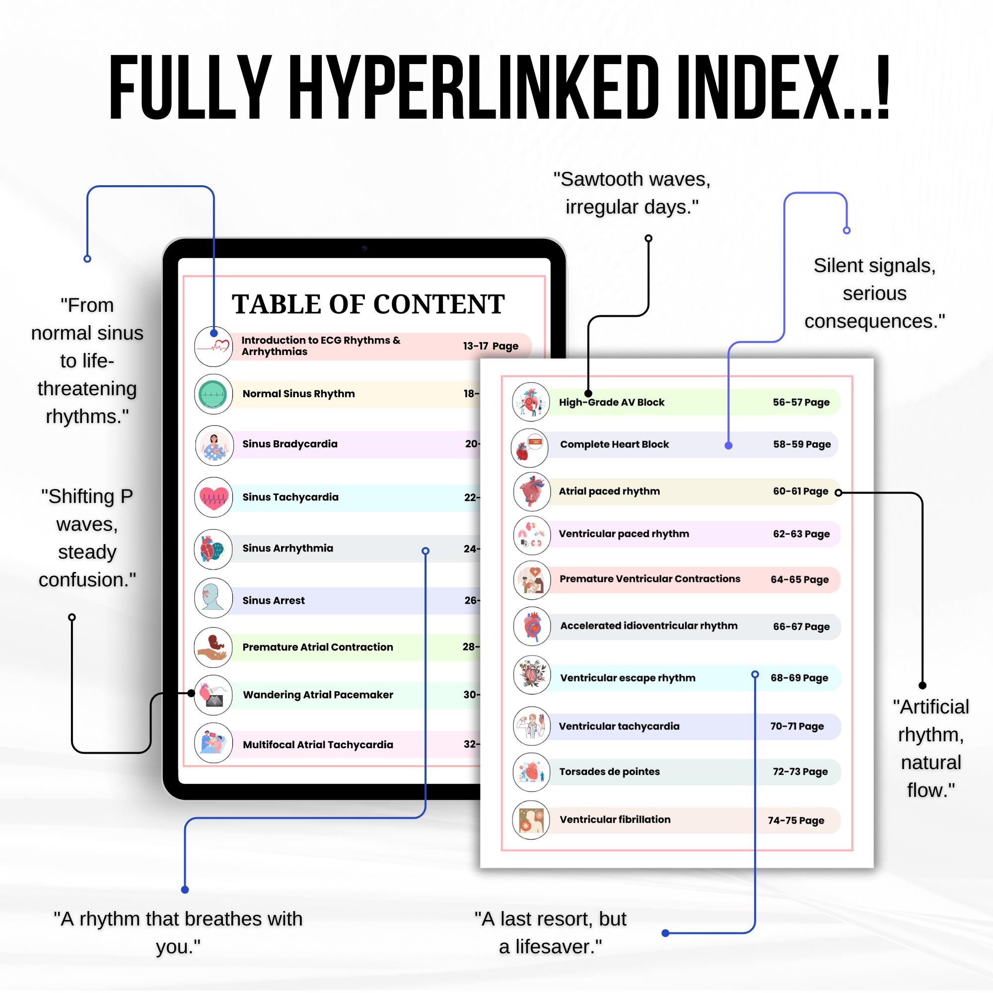 75+ ECG Rhythm & Arrhythmias Cheat Sheet, ECG Study Guide, Nursing ...