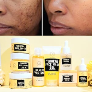 Full Turmeric Skincare Kit| Skincare Kit, Natural Skincare, Skin Care ...