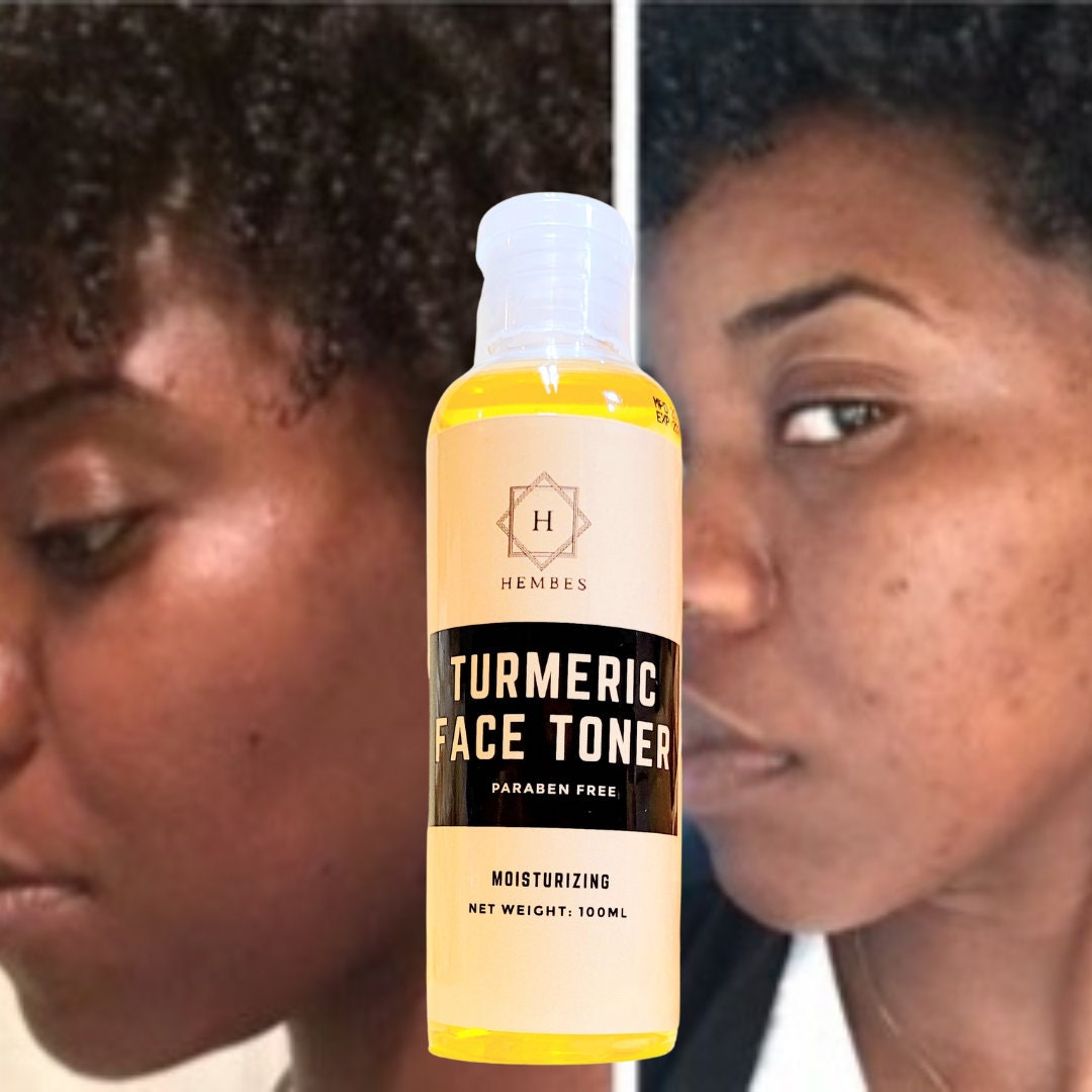 Turmeric Vitamin C Face Toner, Face Toner, Turmeric Toner - Etsy