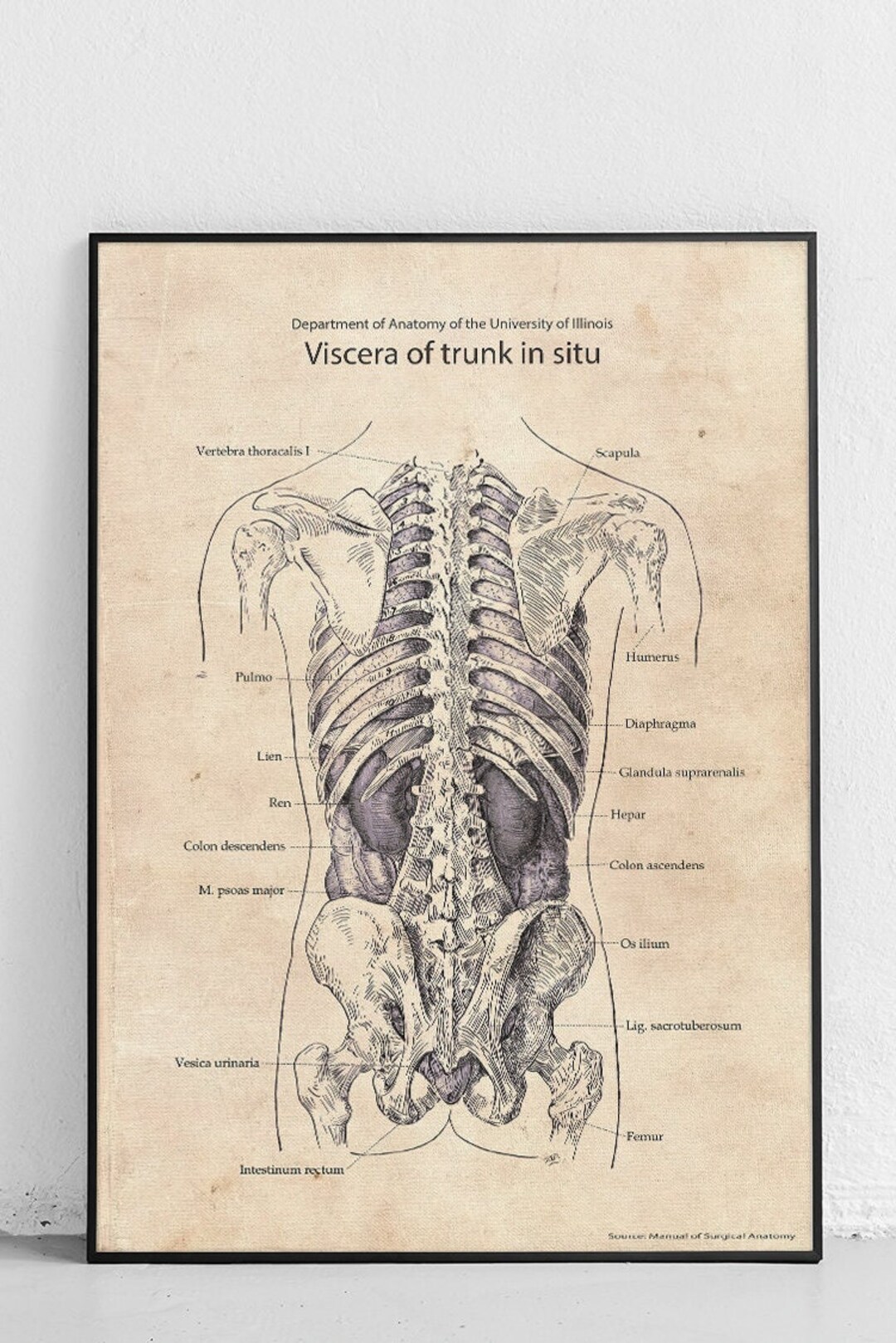 Dissection of Abdomen Original Poster - Etsy