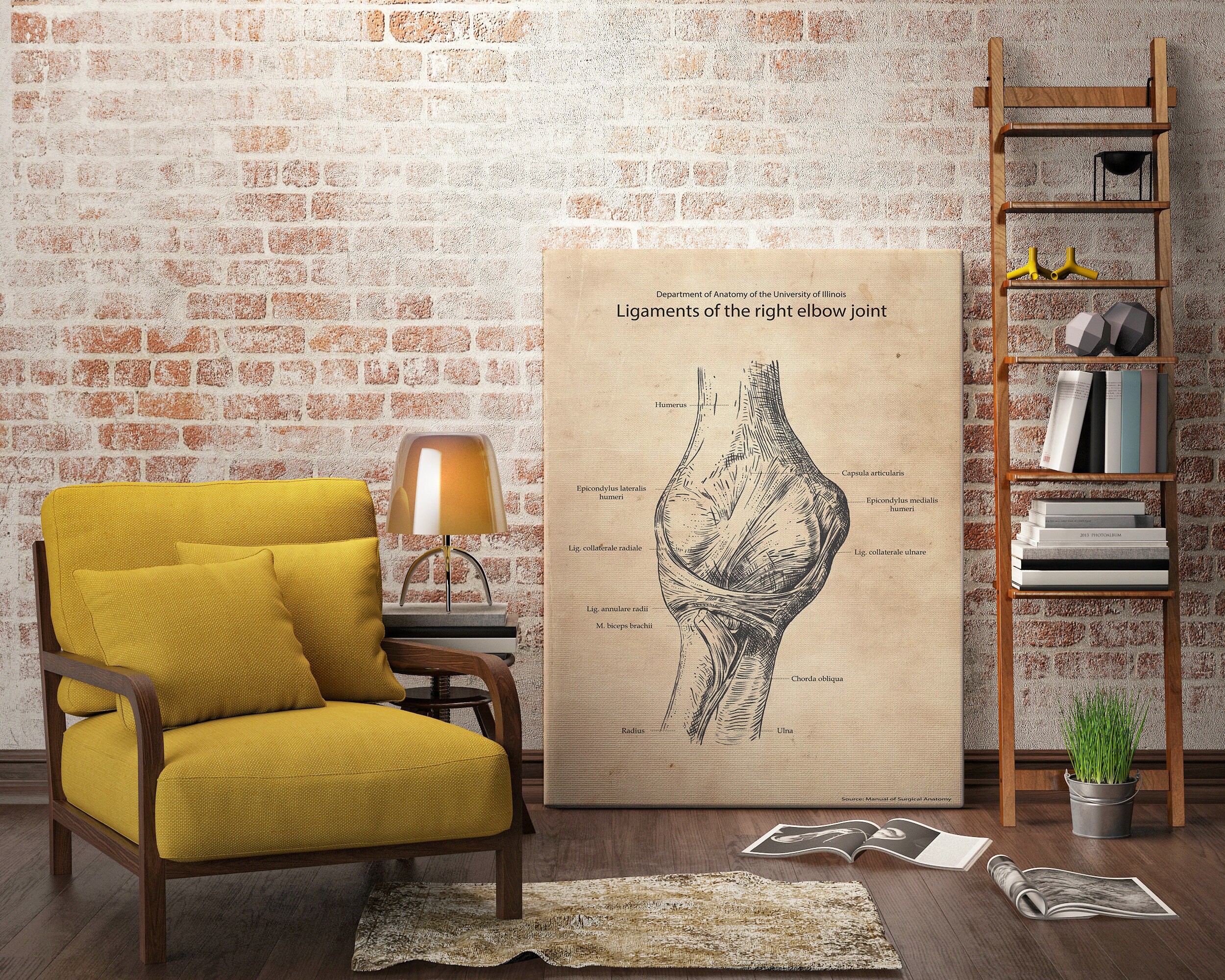 Elbow Ligament - Original Poster - Etsy