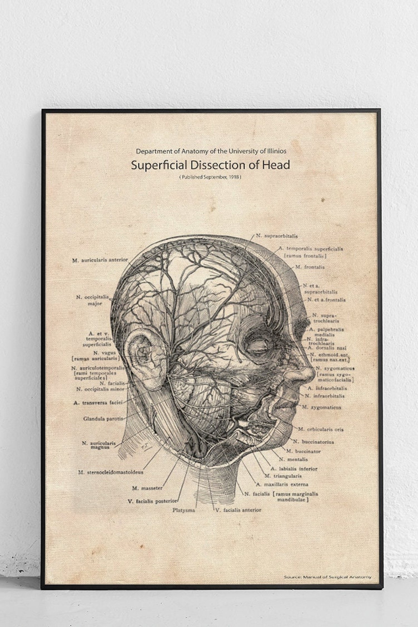Superficial Dissection of Head Original Poster - Etsy