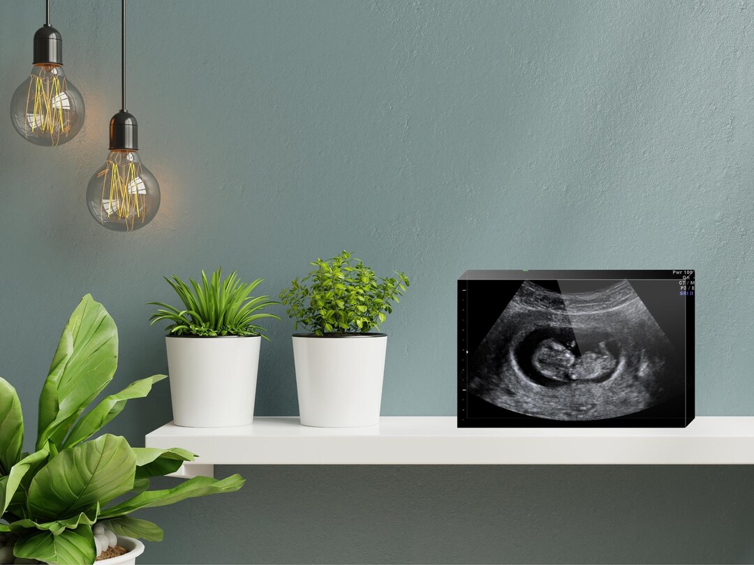 Custom Ultrasound Photo Printed on Acrylic Blocks, Personalized Gift ...