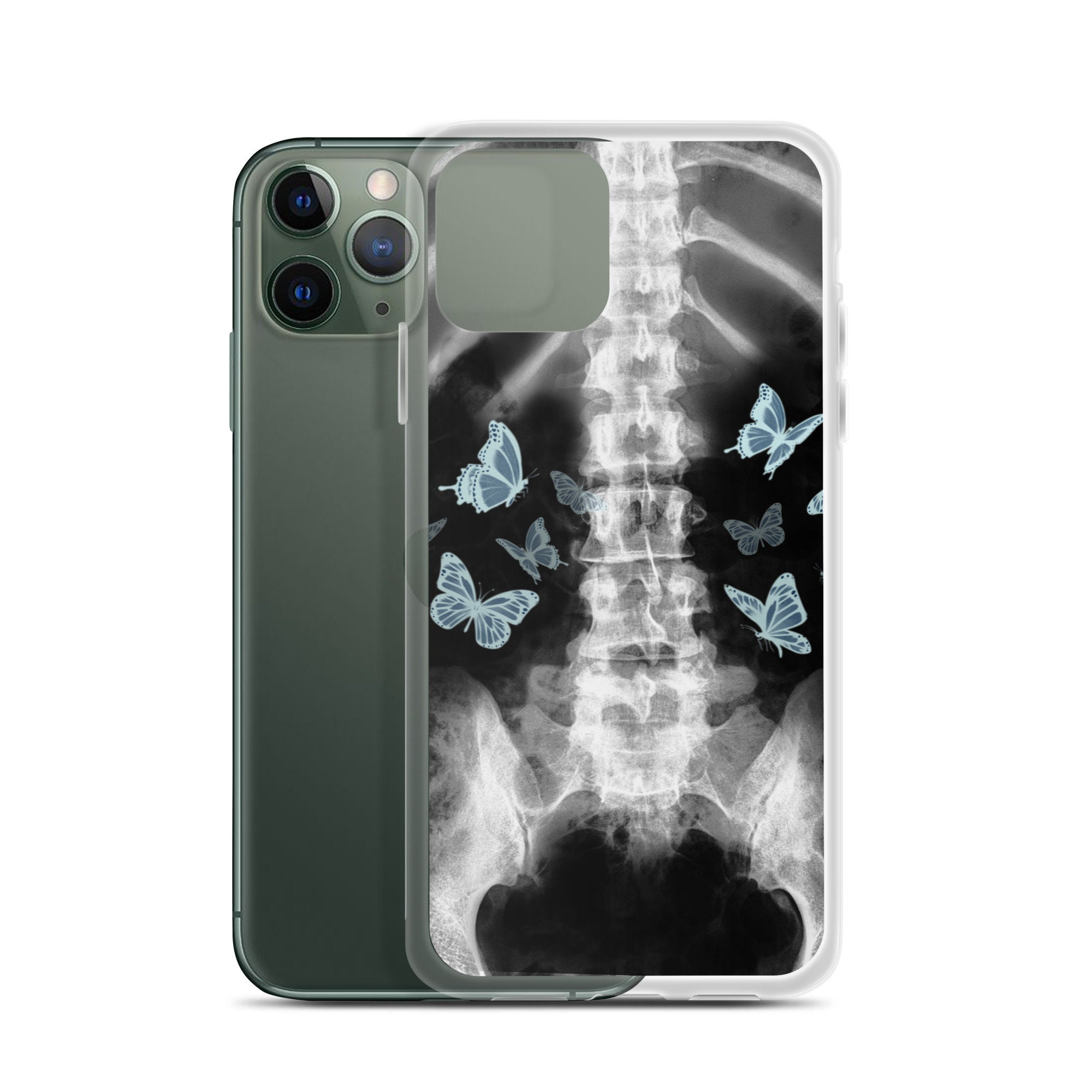 Egirl Xray Skeleton With Blue Butterfly iPhone Case, Perfect for Y2K ...