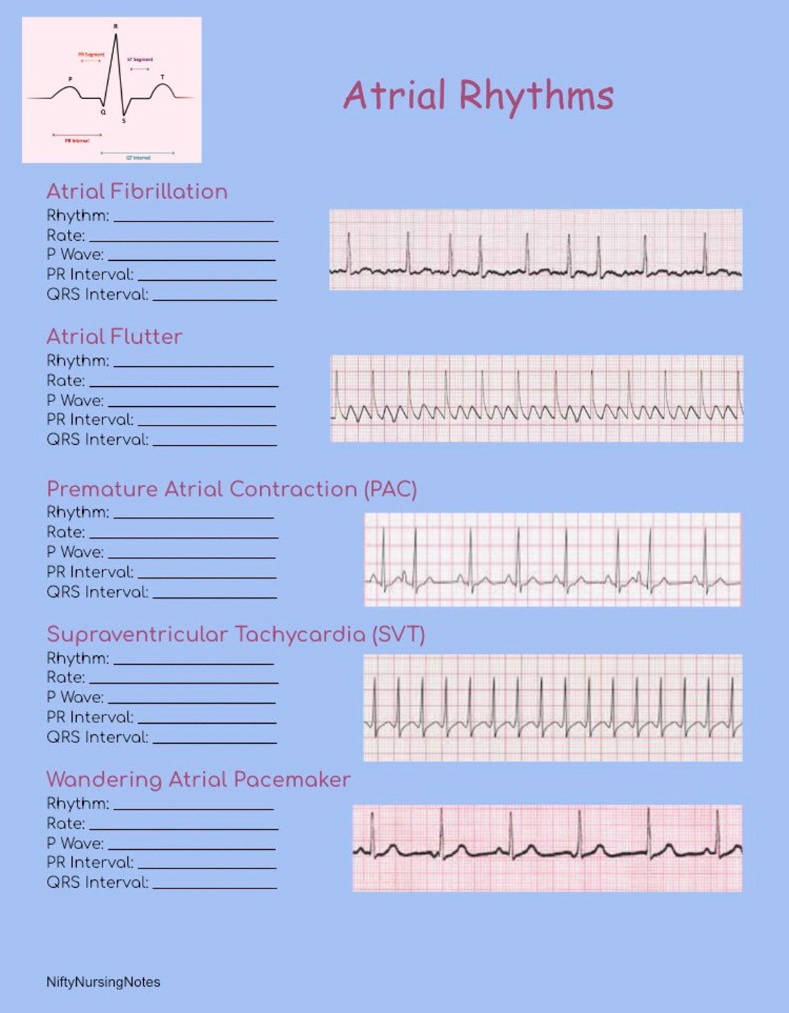 ECG Interpretation Made Easy - Etsy