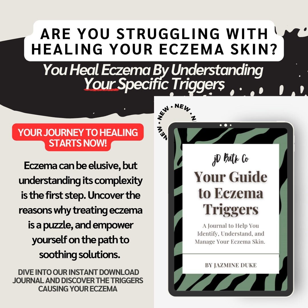 Prevent Your Eczema Triggers Digital Download Journaling Holistic ...