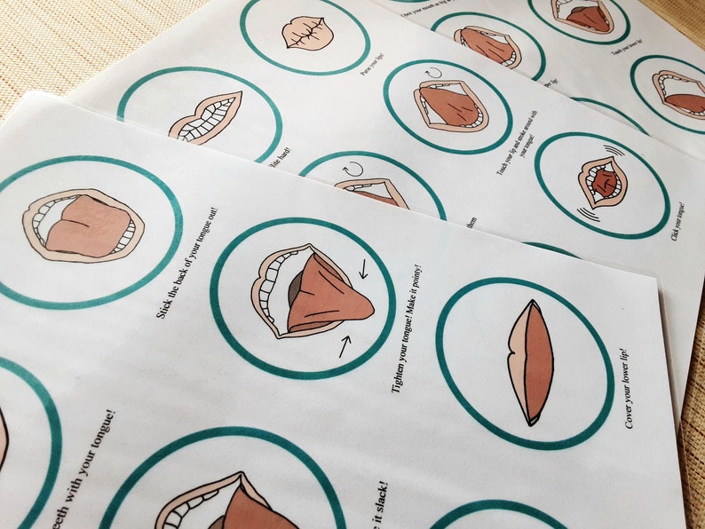 Tongue Exercises 18 Pictures of the Oral Area Practising Speech Therapy ...