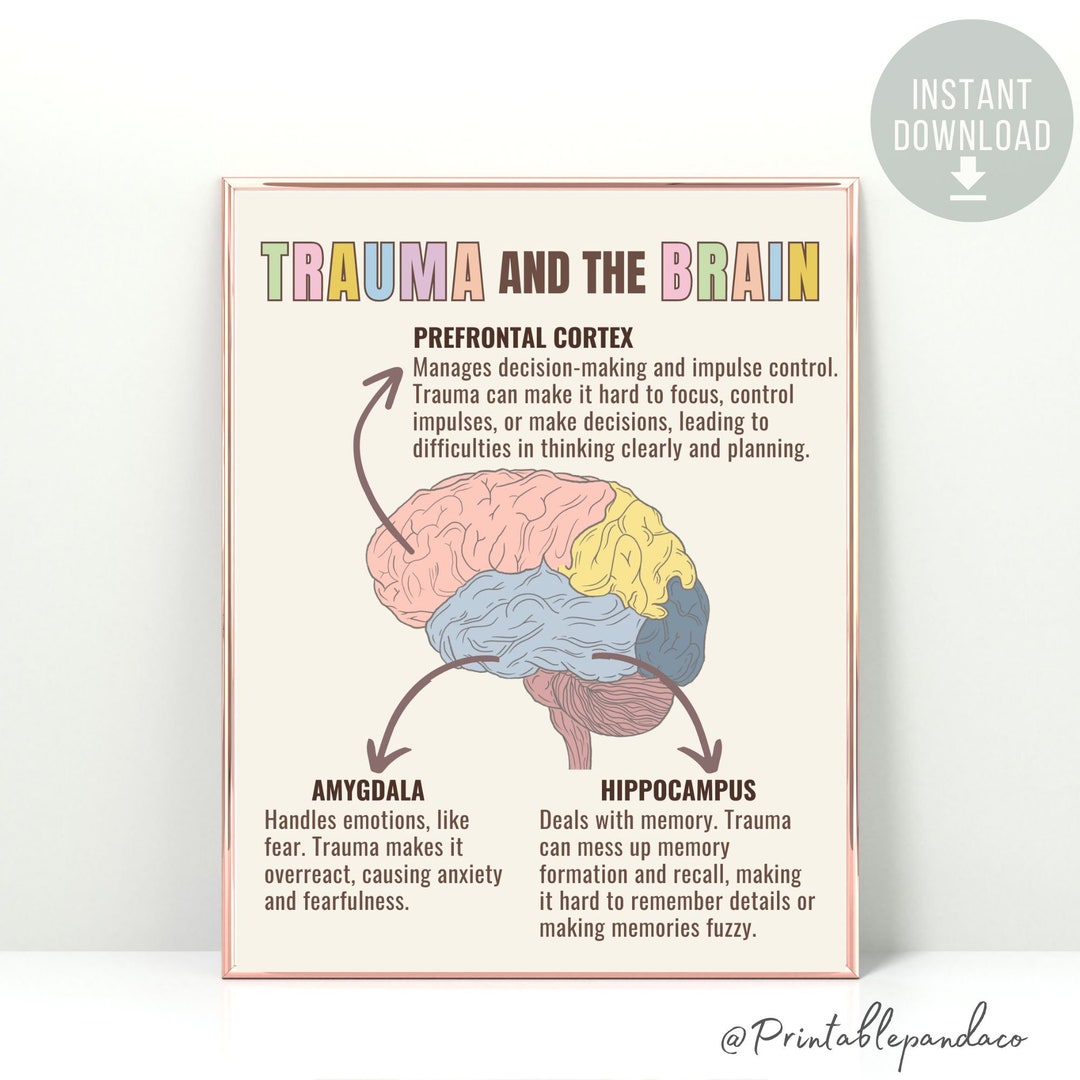 Trauma and the Brain Poster, Trauma Poster, Therapy Office Decor, PTSD ...