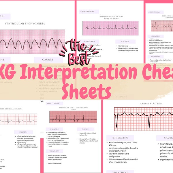 Ekg Cheat Sheet Etsy