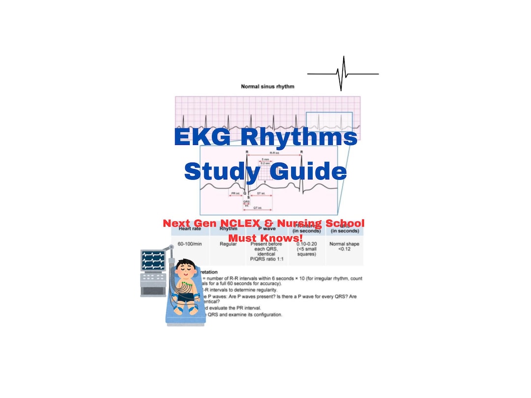 EKG Rhythms Study Guide: Next Gen NCLEX Nursing School Must Knows - Etsy