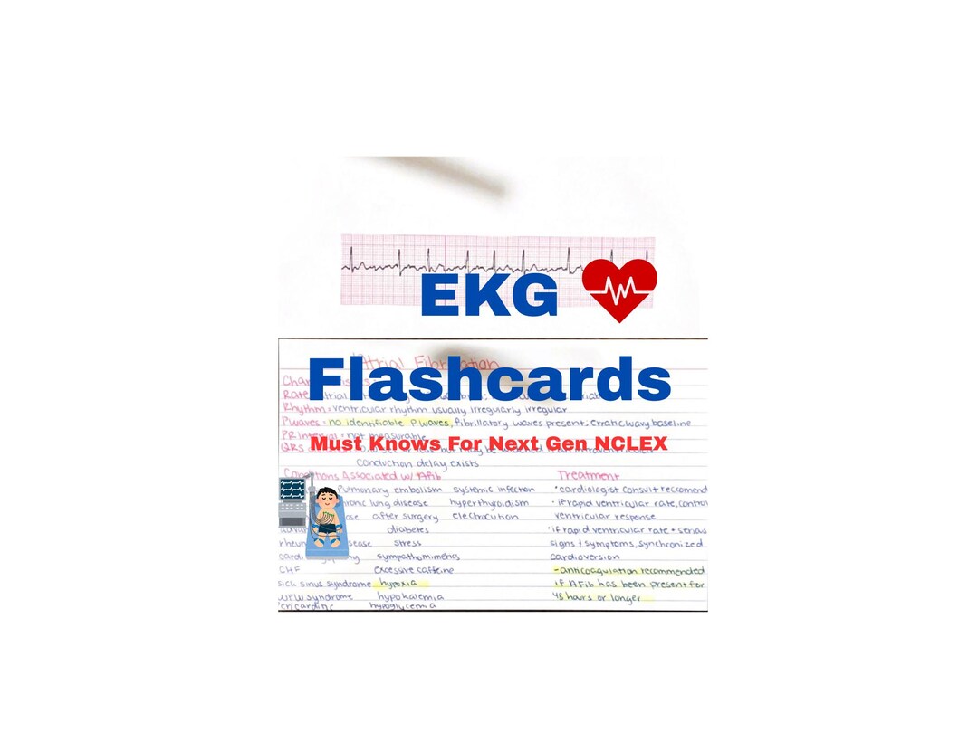 ECG Rhythm Note Cards in a PDF Format - Etsy
