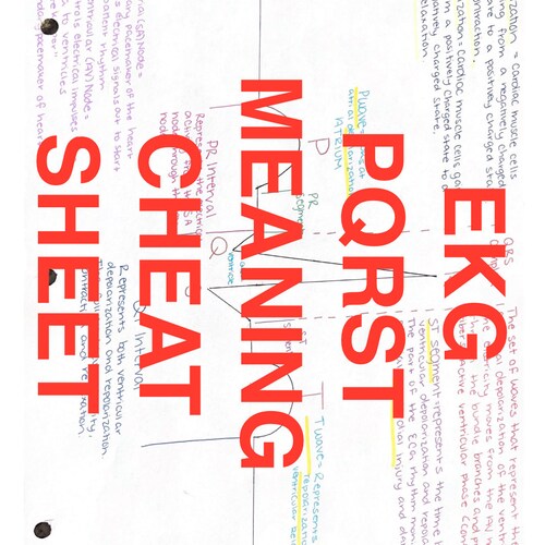 Routine EEG Cheat Sheet - Etsy Israel