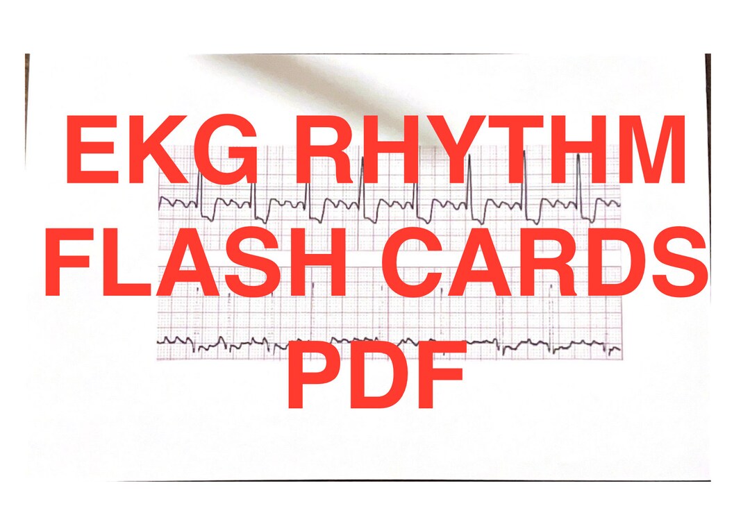 ECG Rhythm Note Cards in a PDF Format - Etsy