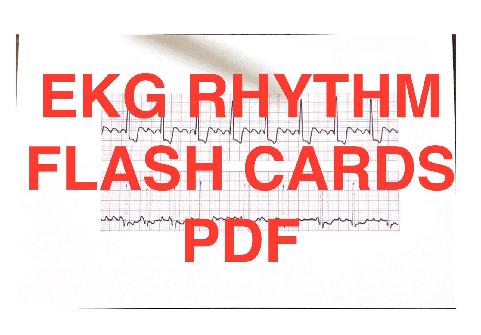 ECG Rhythm Note Cards in a PDF Format - Etsy