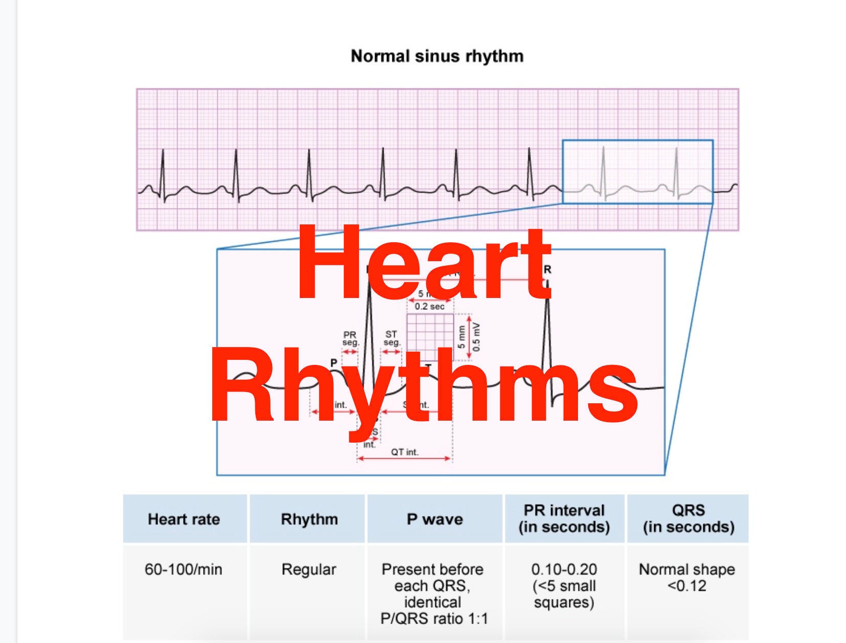EKG Rhythms Study Guide: Next Gen NCLEX Nursing School Must Knows - Etsy